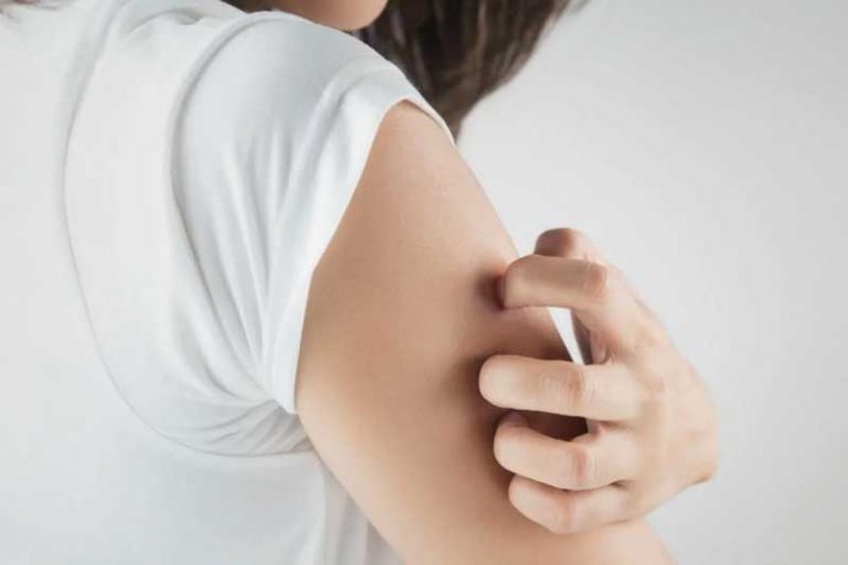 ️ PULGAS EN HUMANOS: Todo lo que necesitas saber.